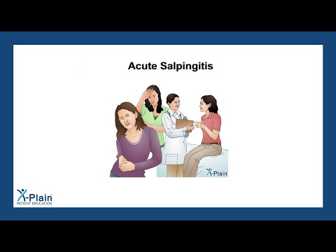 Acute Salpingitis