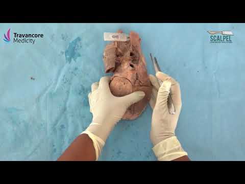Heart-External Features