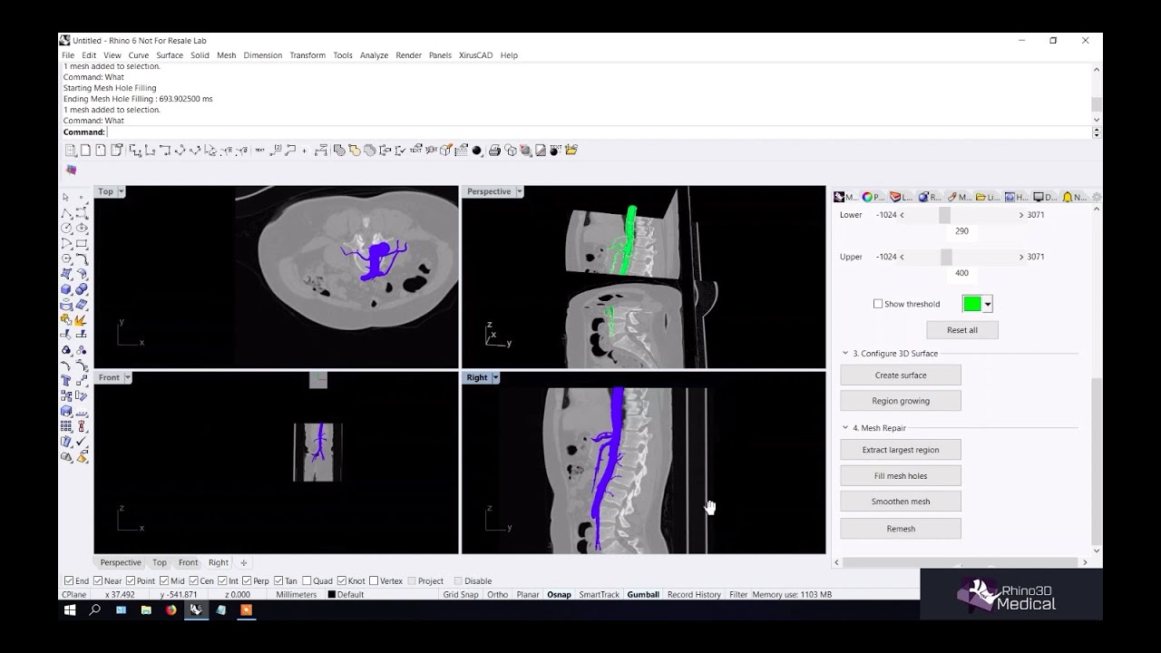 Tutorial: Segmentation (Region growing)