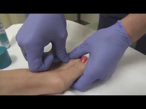 Broken Toe Emergency