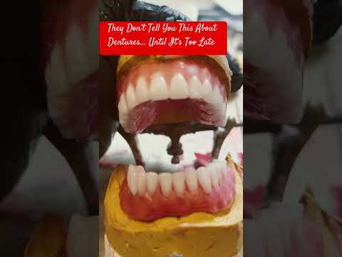 They Don’t Tell You This About Dentures… Until It’s Too Late #dentures #dentalcare #shortvideo #fyp