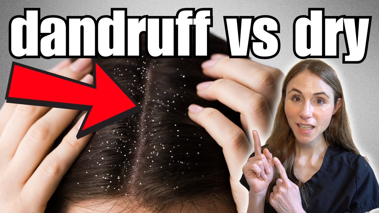 Distinguishing Dandruff From Dry Scalp: Expert Tips For Clearing Up Flakes