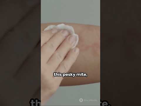 Scabies #scabies #mites #trending