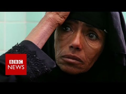 On brink of 'worst famine in 100 years' - BBC News