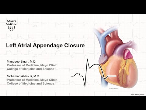 Left Atrial Appendage Closure