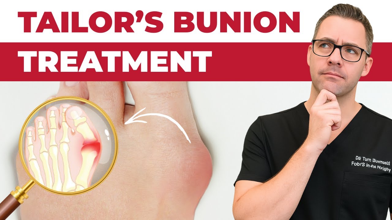 #1 Tailor's Bunion & Bunionette Treatment? [Correctors? Surgery?]