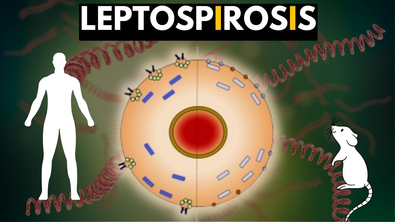 Leptospirosis, Causes, Signs and Symptoms, Diagnosis and Treatment