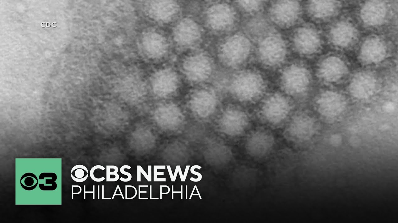 Record number of norovirus outbreaks surge across the U.S., CDC says