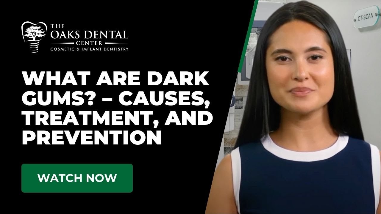 What Are Dark Gums? – Causes, Treatment, and Prevention | The Oaks Dental Center