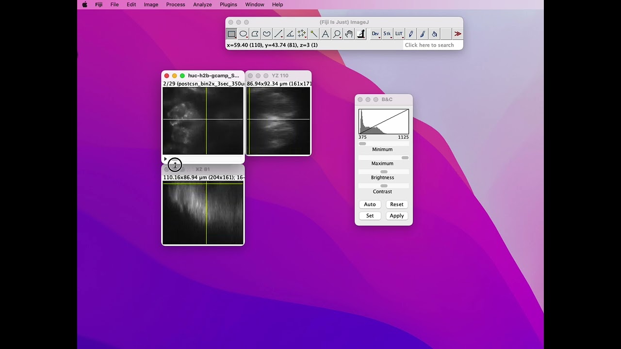 Fiji Image Analysis Crash course #004: Reslice 3D data