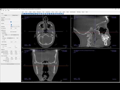 TxSTUDIO 6 Section View: Getting Started, Part 1