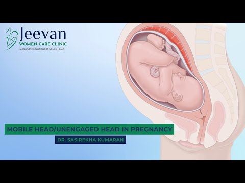 Mobile Head / Unengaged Head in Pregnancy | Dr Sasirekha Kumaran | Jeevan Women Care