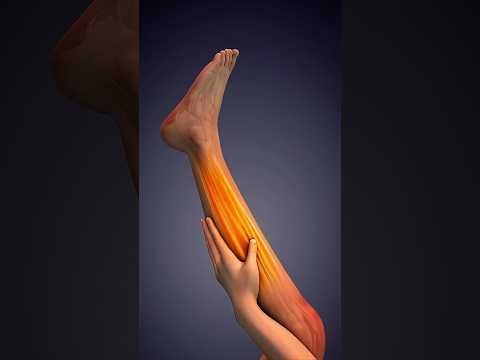 Deep Vein Thrombosis due to prolonged lack of movement #DVT #surgery