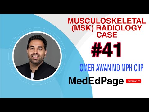 Musculoskeletal (MSK) Radiology CASE #41