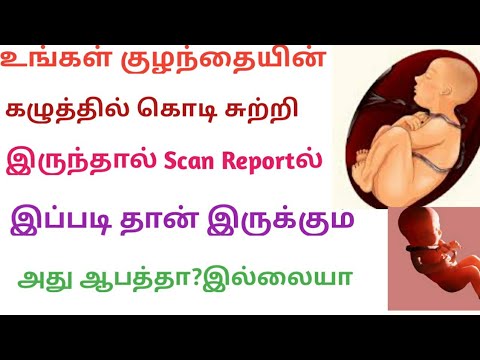 How To Mention to Cord around the neck | Boy scan report tamil @Malarinchezhiyan