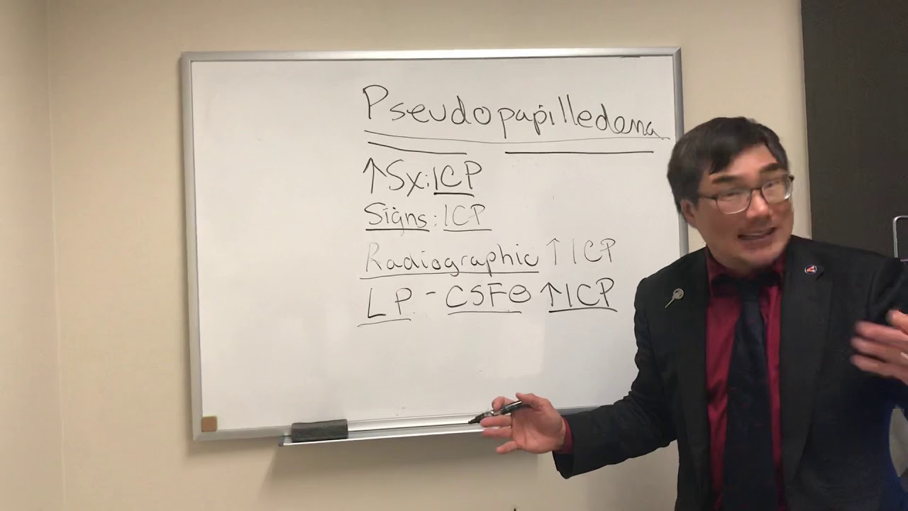 Pseudo-Papilledema