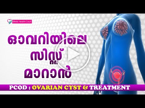 Ovarian Cyst Symptoms & Ovarian Cyst Treatment in Malayalam | Dr Bindu | Ethnic Health Court