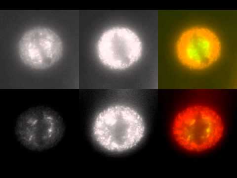 Live-cell imaging of rapamycin-induced rerouting of TACC3 to mitochondria.