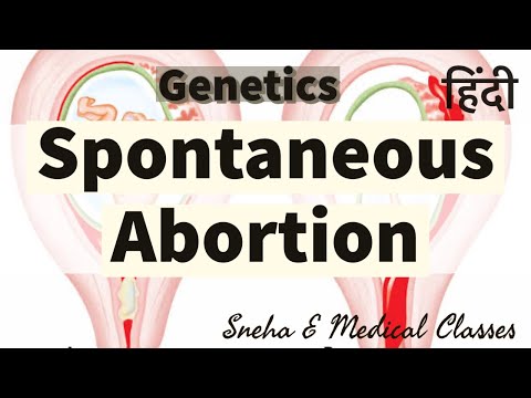 Spontaneous Abortion !! Types !! Causes !! Management !! Hindi !! Genetics !!