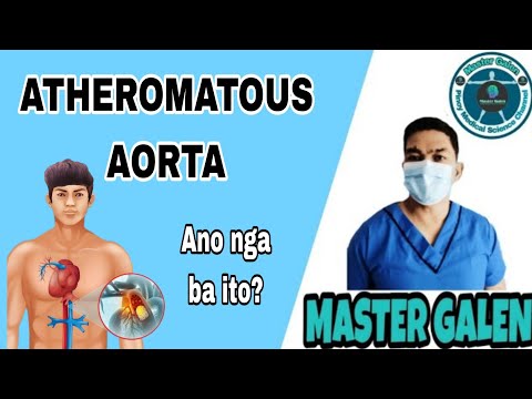 Ano ang Atheromatous Aorta