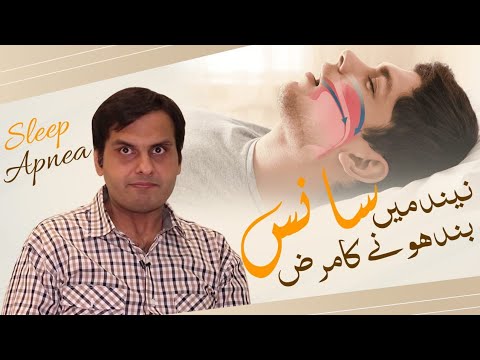 Obstructive sleep apnea explained in urdu