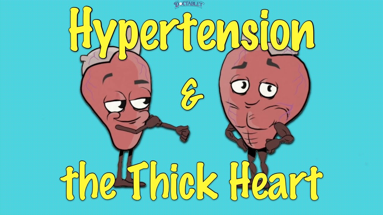 Left Ventricular Hypertrophy (LVH) and Hypertension