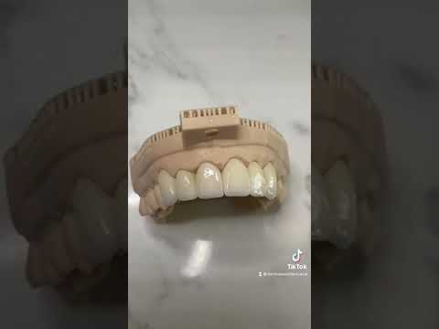 How ceramic veneers are made in our lab! #shorts