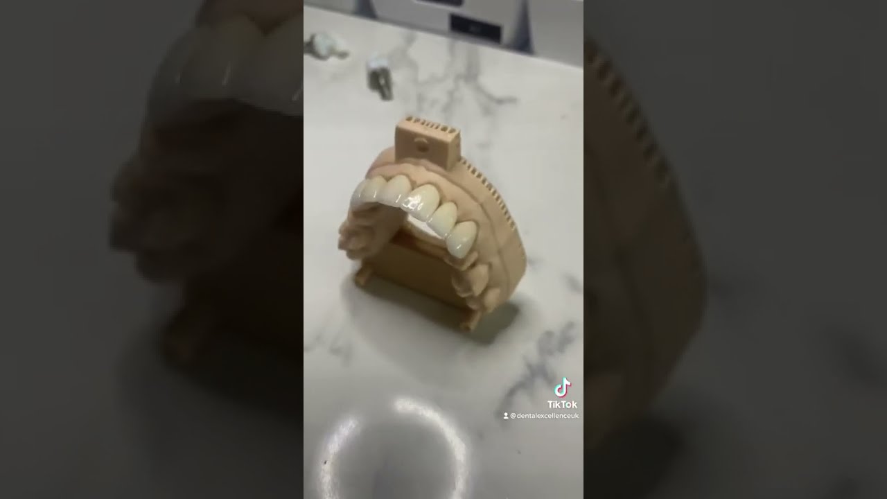 How ceramic veneers are made in our lab! #shorts