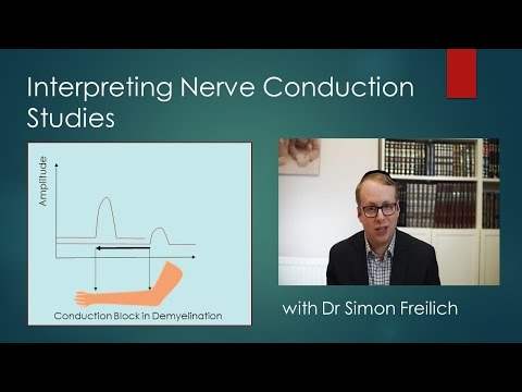 Interpreting Nerve Conduction Studies