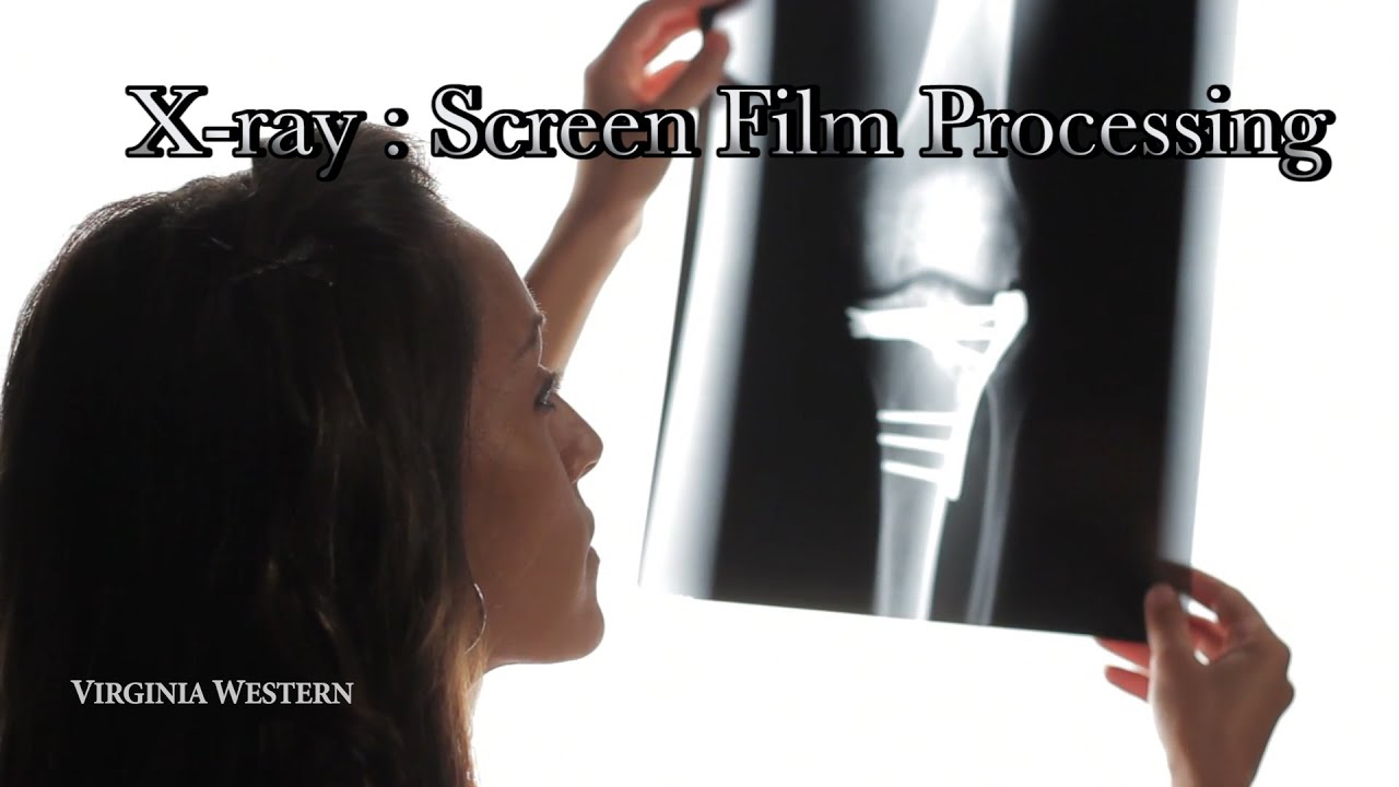 Xray Film Screen Processing