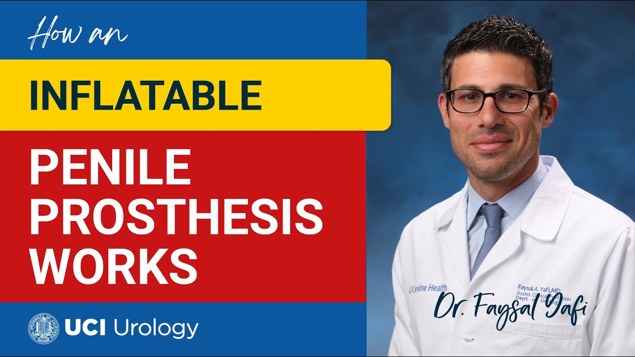 How an Inflatable Penile Prosthesis Works by Dr. Faysal A. Yafi - UCI Department of Urology