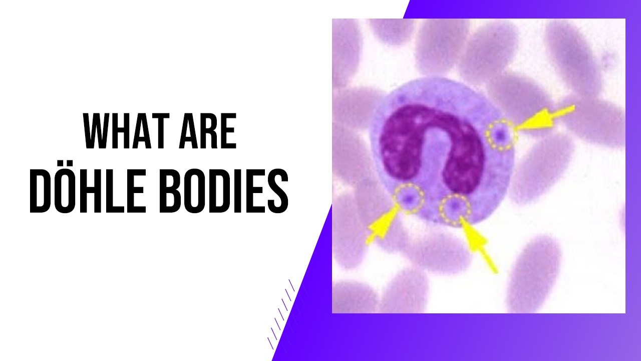 How to Identify Döhle Bodies 🔍 | Hematology Made Simple 📚