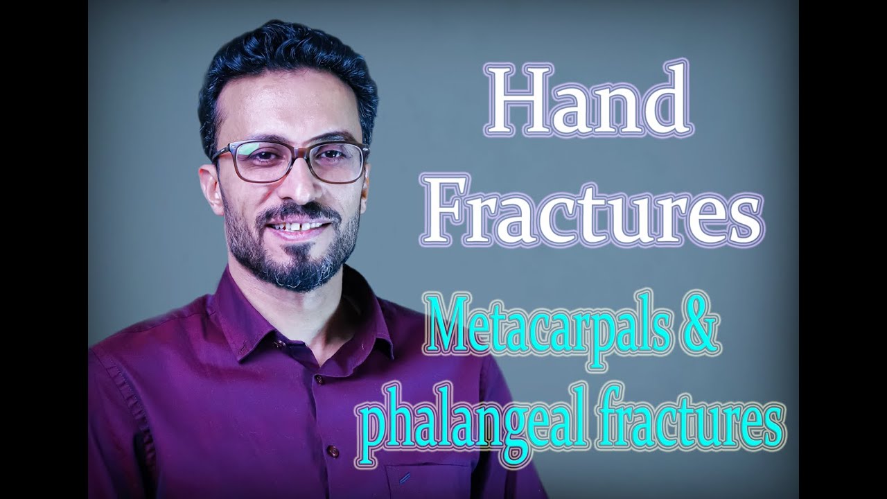 08  Hand fractures: Metacarpals & phalangeal fractures