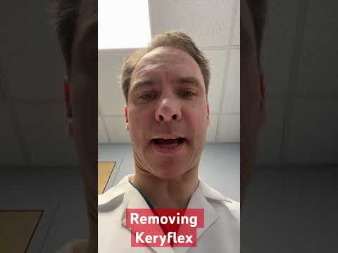 Removing Keryflex nail #centralmasspodiatry