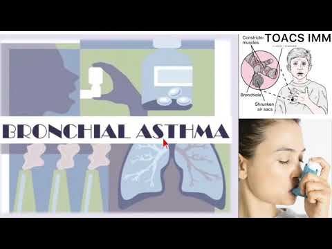 Bronchial Asthma | Pathophysiology | Types | Clinical Presentation | Drug Treatment