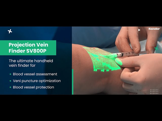 Vein Finder - SV800P Projection Vein Finder Trader - Wholesaler ...