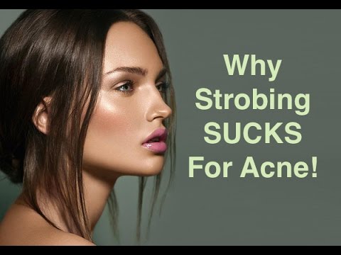 Why Strobing & Highlighting SUCKS For Acne! | Cassandra Bankson