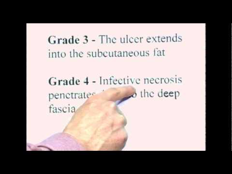 Pressure sores 5, Grading and assessment