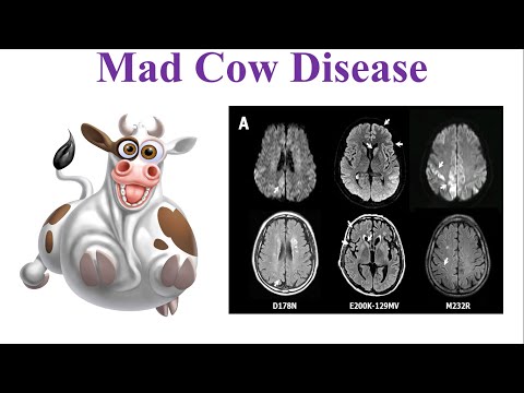 What is Mad Cow Disease? || Bovine Spongiform Encephalopathy || BSE || vCJD || How Prion Kills?
