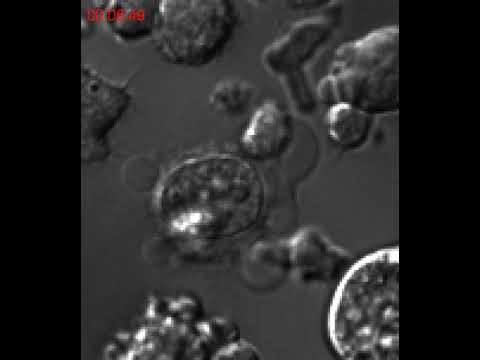 Meet the Unsung Immune Cell that Could Change Immunotherapy (Natural Killer Cells)