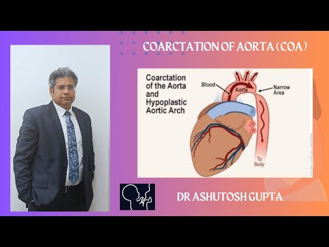 Coarctation of Aorta (CoA)