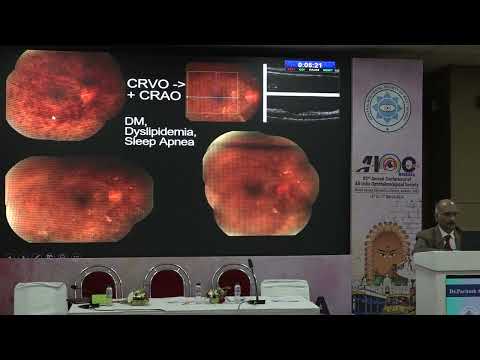 AIOC2024 GP137 Topic Dr Paritosh Arvind Kamdar Frankenstein Findings on Fundus examination and Ima