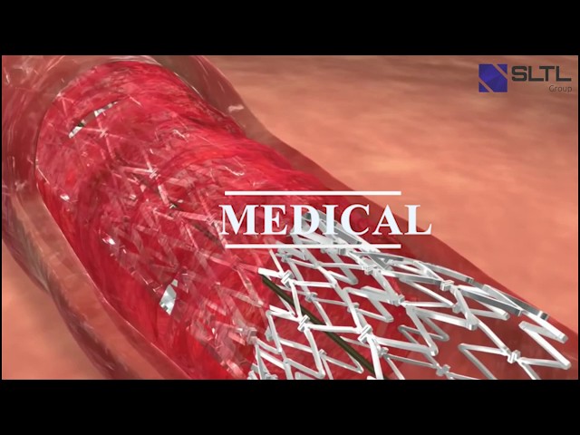 Drug Eluting Coronary Stent - EverPro - Drug Eluting Coronary Stent ...