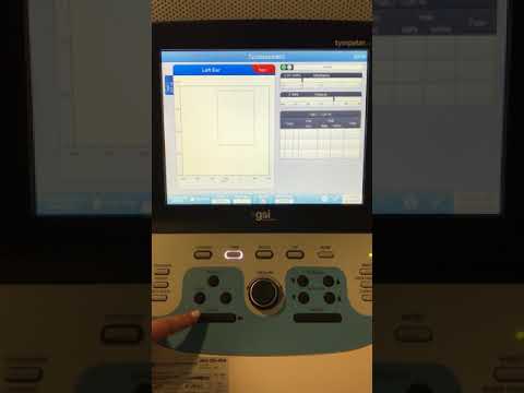 Tympanometry