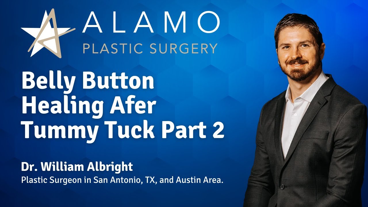 Belly Button Healing After a Tummy Tuck Part 2