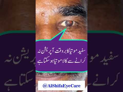 What happens when cataract is matured? | Urdu Hindi