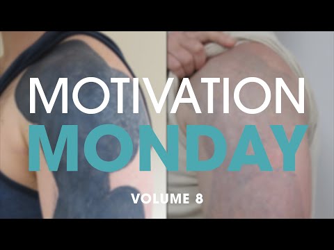 Full Bicep Blackout Tattoo Removal | Motivation Monday Volume 8 | Removery