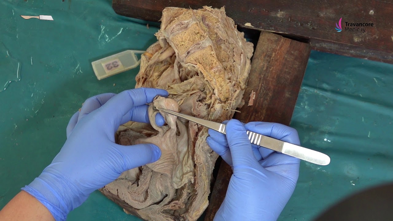 Female Pelvis  Sagittal Section