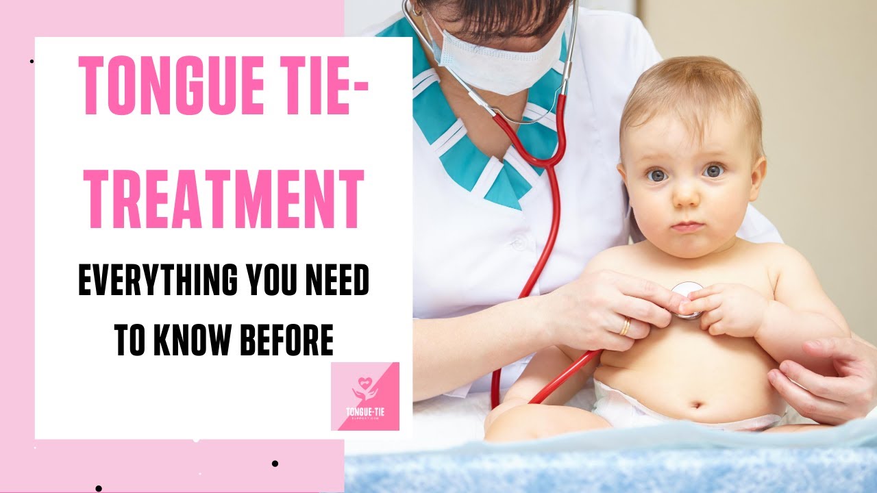 Tongue Tie Treatment: Everything you need to know BEFORE.