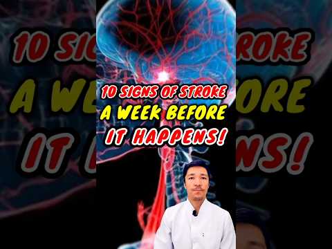 10 Warning Signs of Stroke a Week Before it HAPPENS